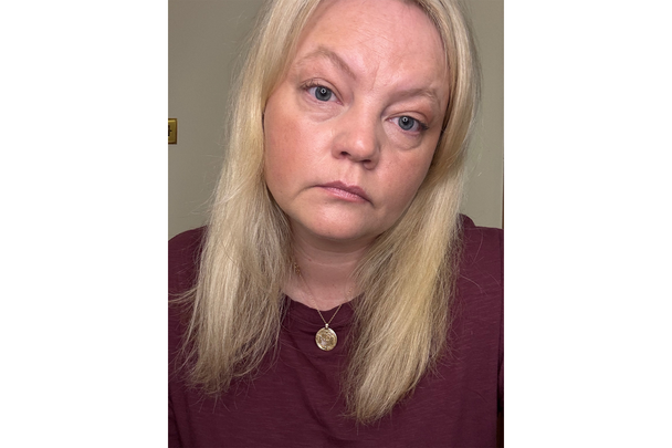 The Ordinary’s new Volufiline serum is out now, and made me look ‘more ...