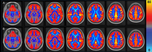 The common snack that helped enhance memory and brain function in a 16 ...