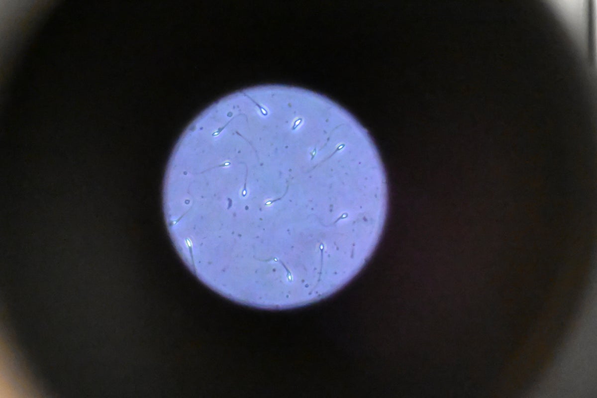 sperm slide under microscope