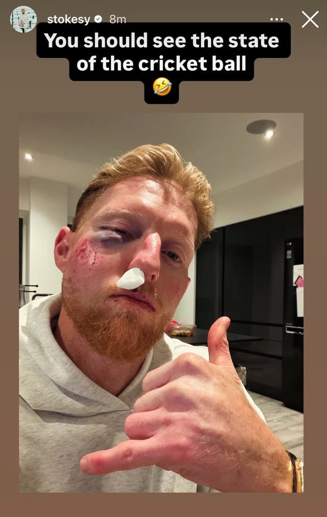 Ben Stokes says he’s ‘quite lucky’ to be alive after horrifying ...