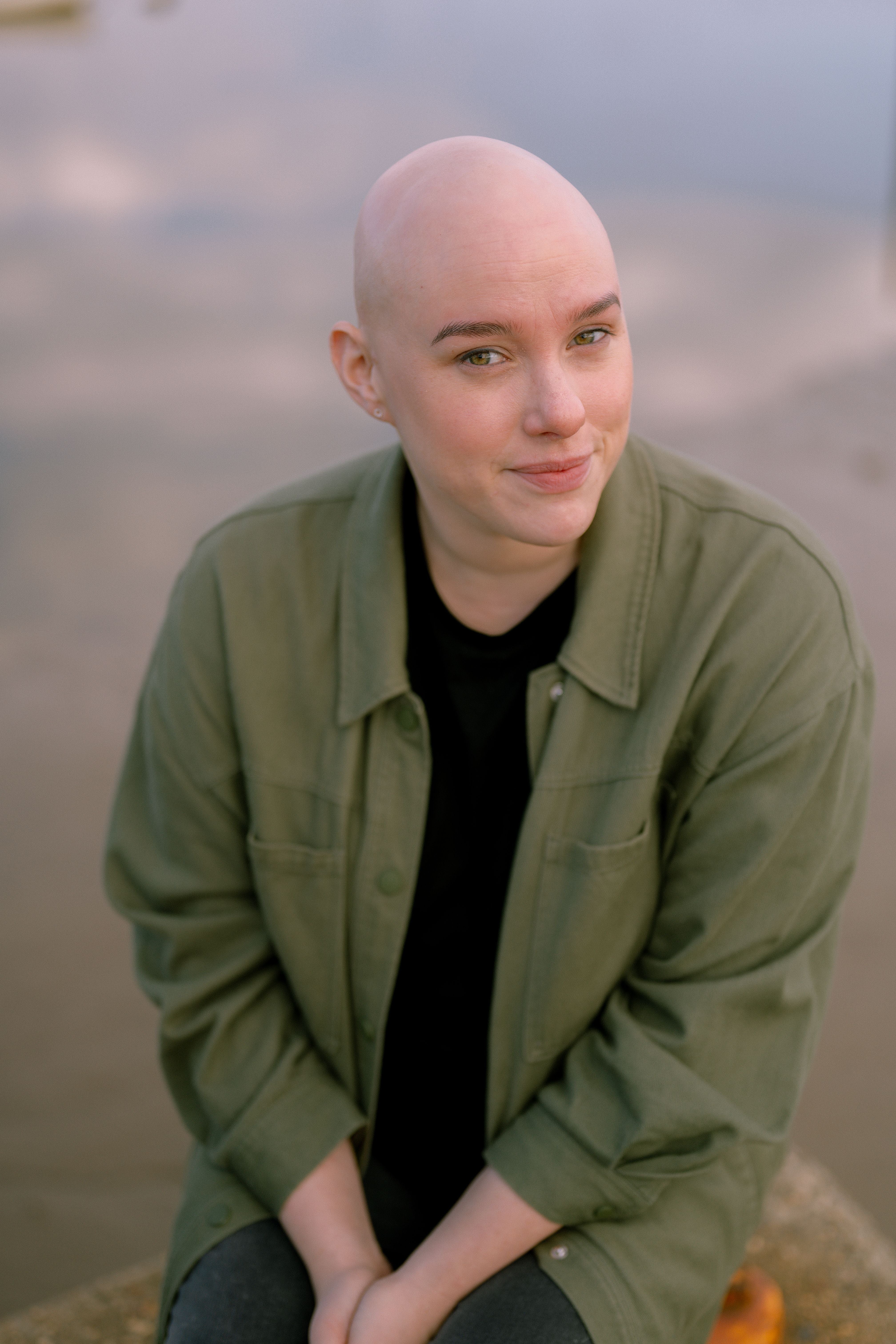 ‘I lost my hair and didn’t go outside for six months’: Should female ...