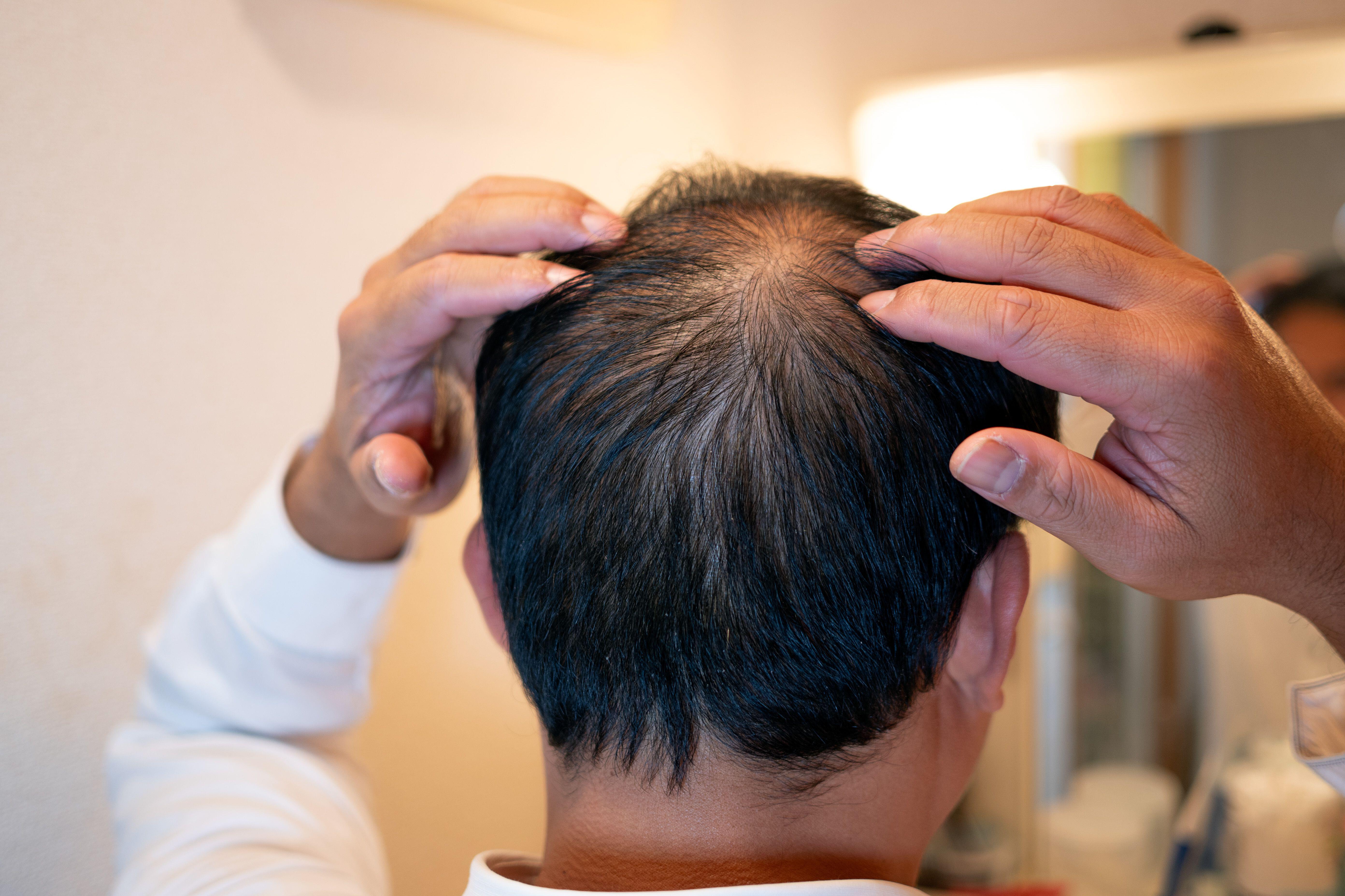 Why is my hair thinning as I get older? | The Independent