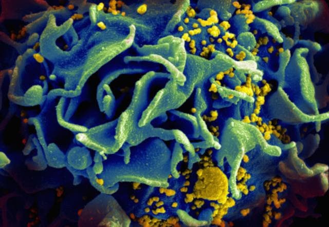 Man ‘cured’ of HIV after brother found to carry rare genetic mutation ...
