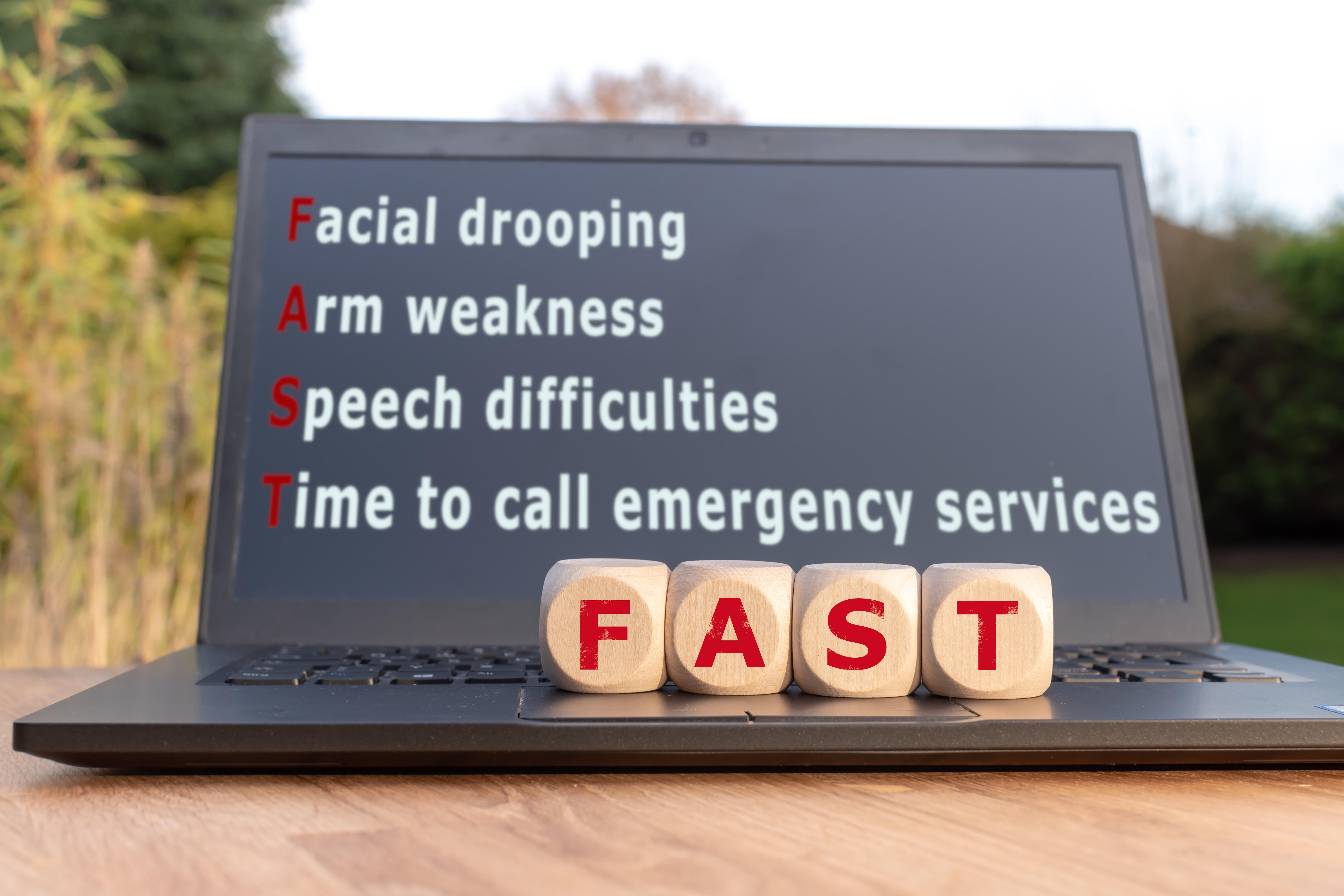 7 dos and dont’s when you spot someone having a stroke