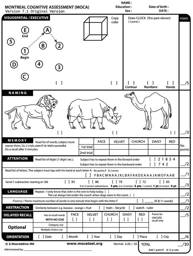 Could you pass a cognitive test? Take the type of challenge Trump ...