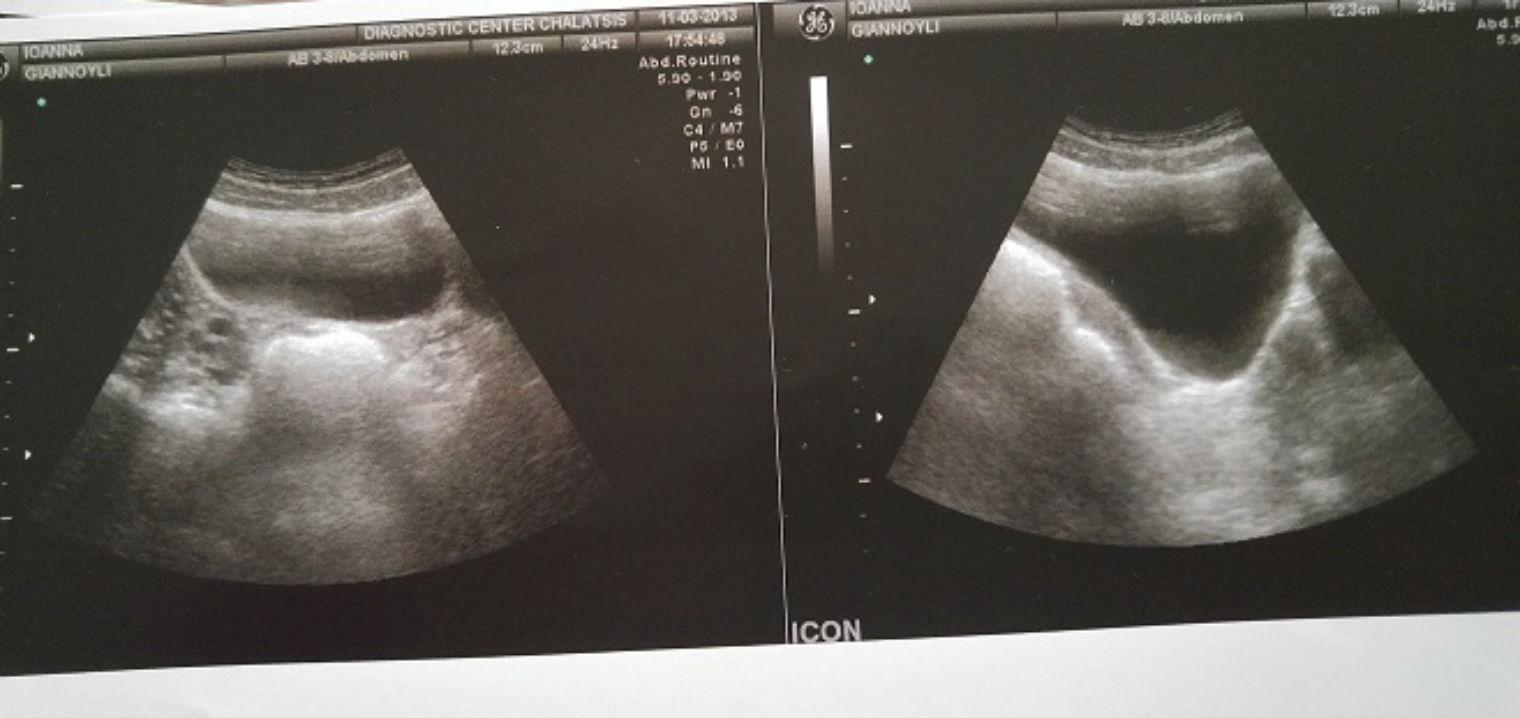 This Is What Life Is Like For A Woman Born Without A Cervix Womb Or