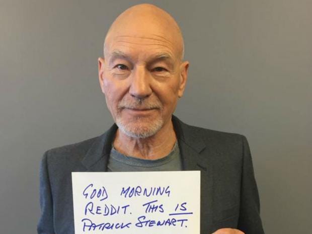 Patrick Stewart Hair