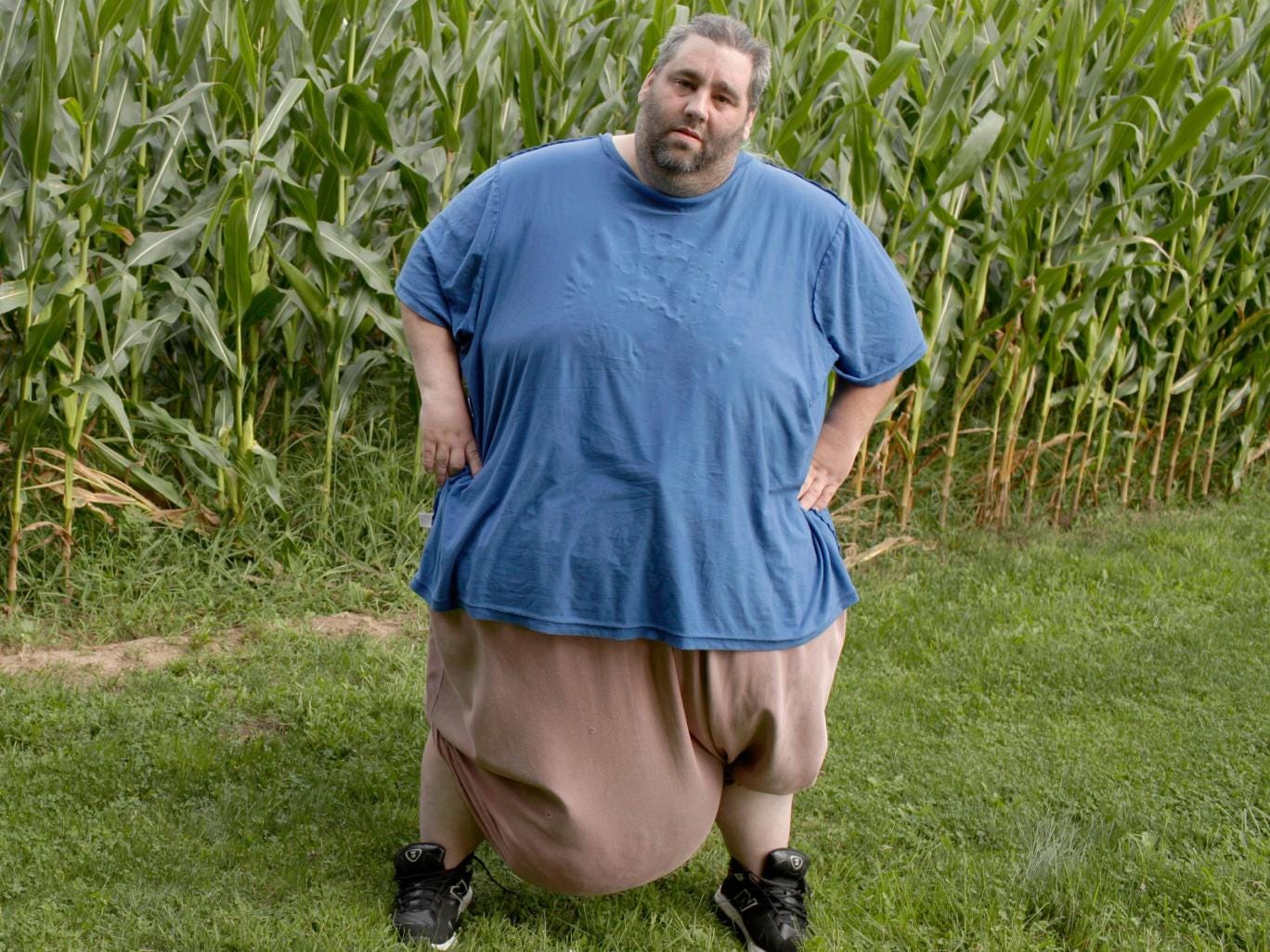 Man has operation to remove 80lb scrotum after…