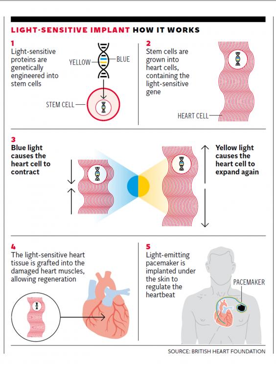 Tests begin on 'traffic light pacemaker' that could revolutionise heart ...