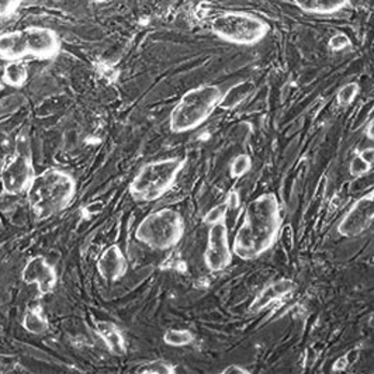 Skin cells shine a light on sleep's 'larks' and 'owls' | The ...