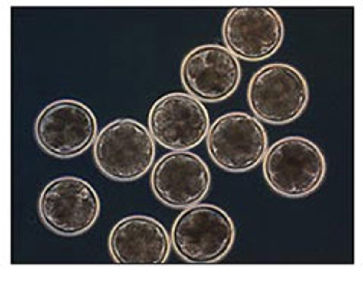 Scientists create Britain's first hybrid embryos | The Independent ...