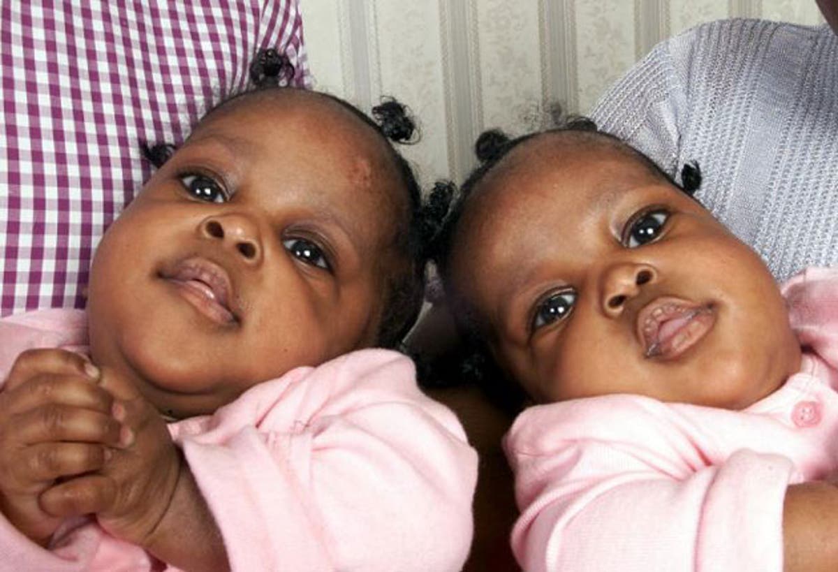 Teenager will give birth to conjoined twins | The Independent | The ...
