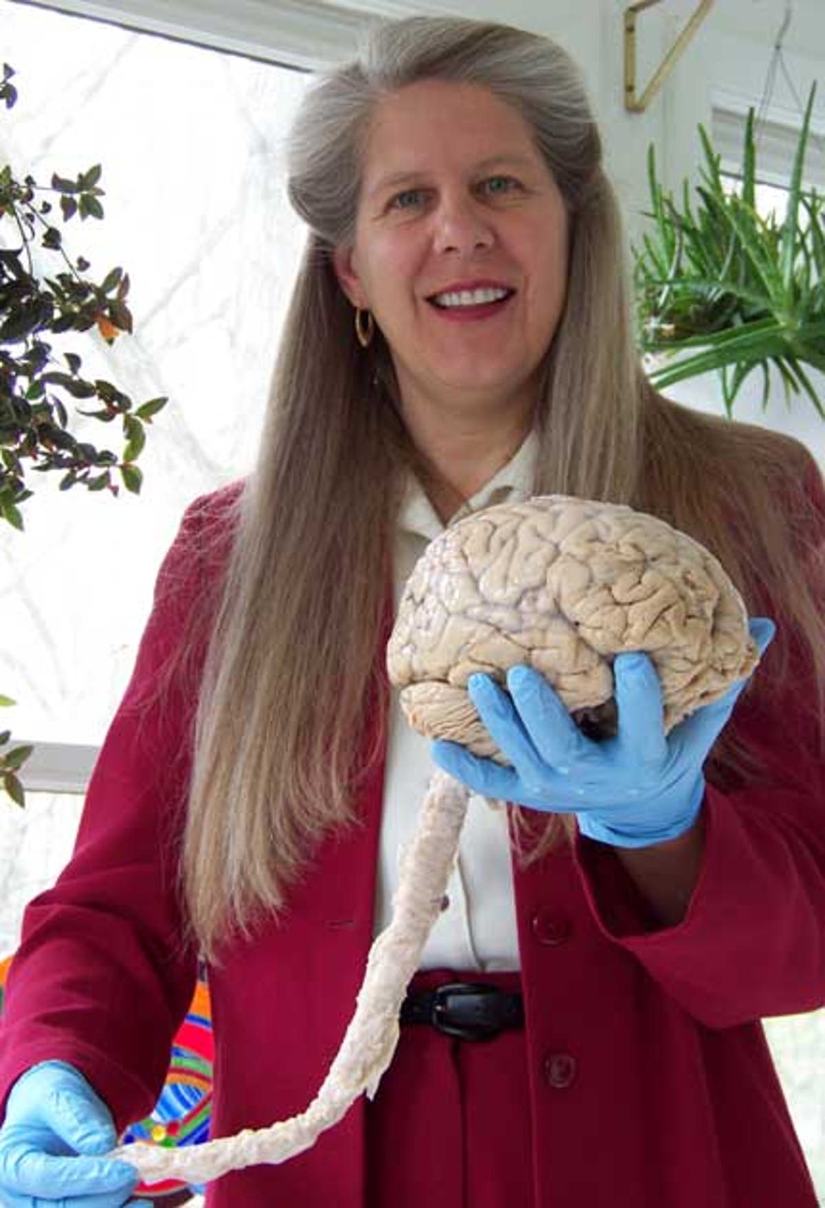 Sudden impact: The facts about strokes | The Independent | The Independent