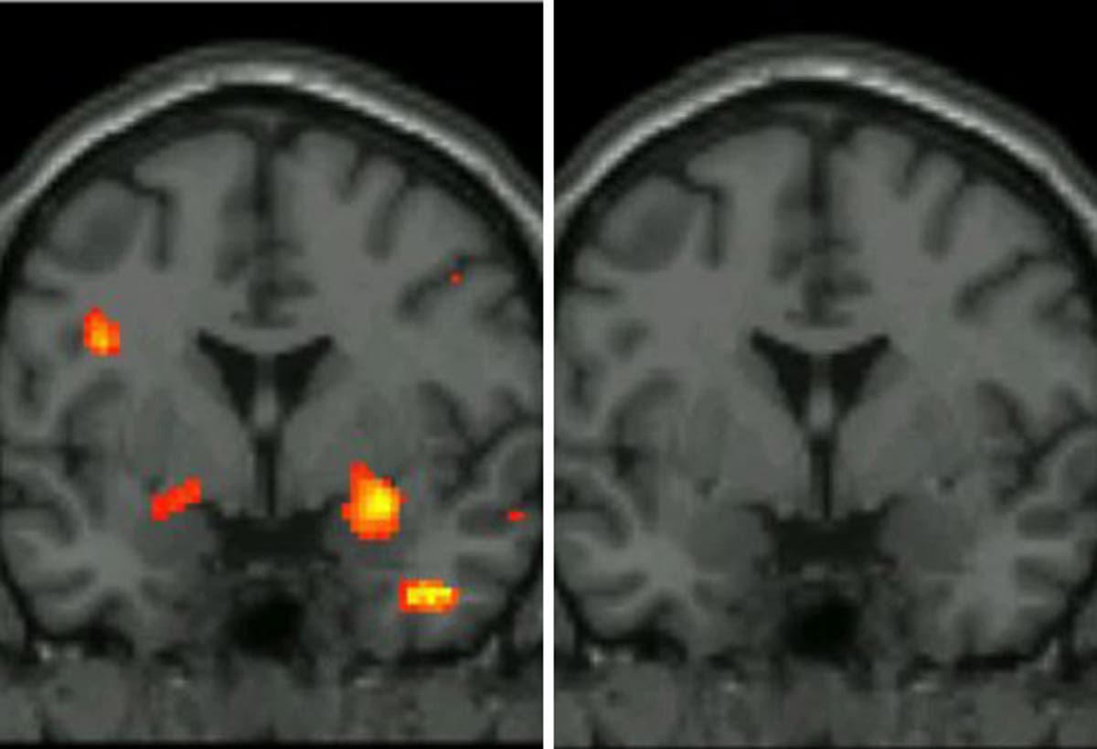 Brain abnormality may be to blame for anti-social teenagers | The ...