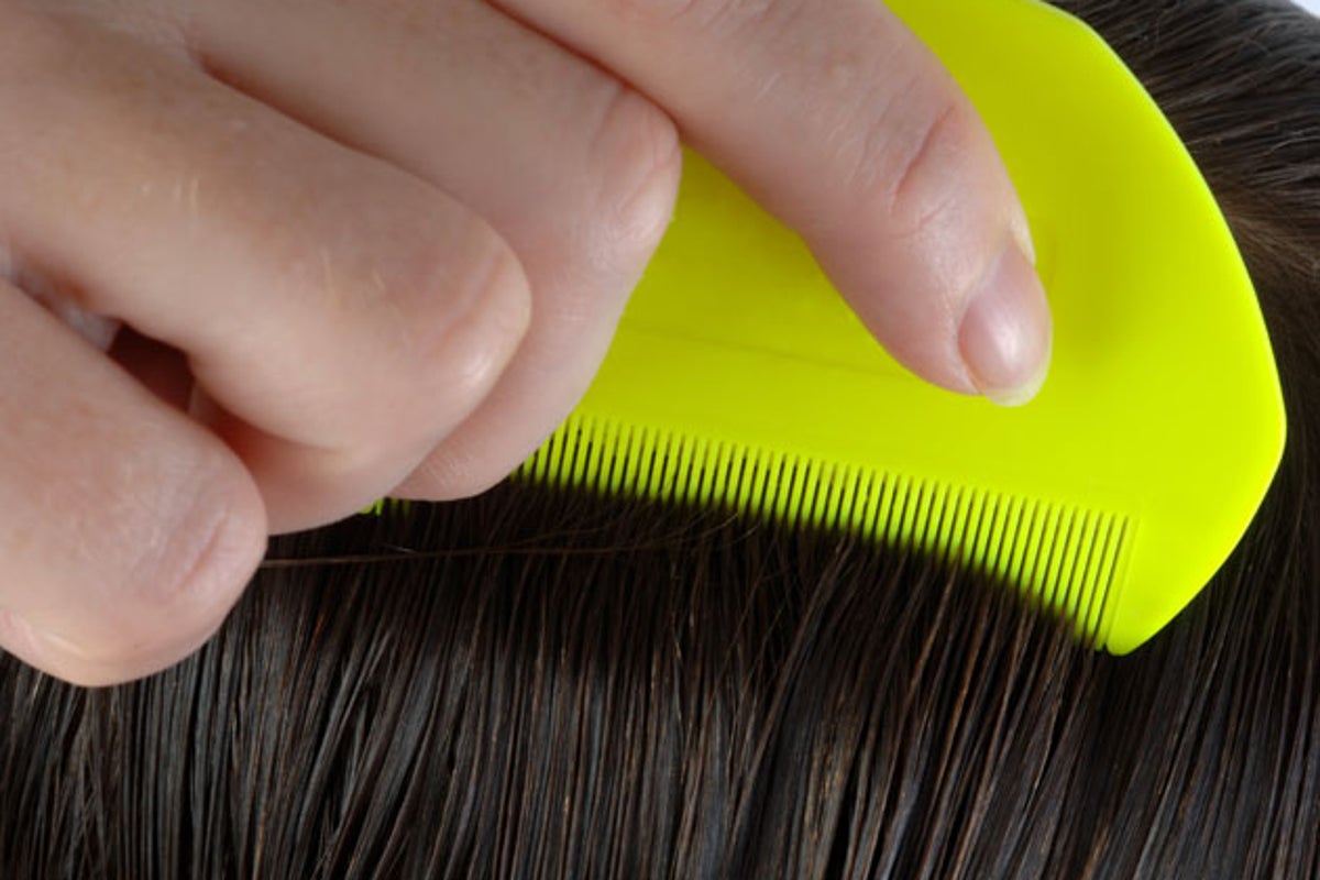 You dirty louse! The rise and rise of nits | The Independent | The ...