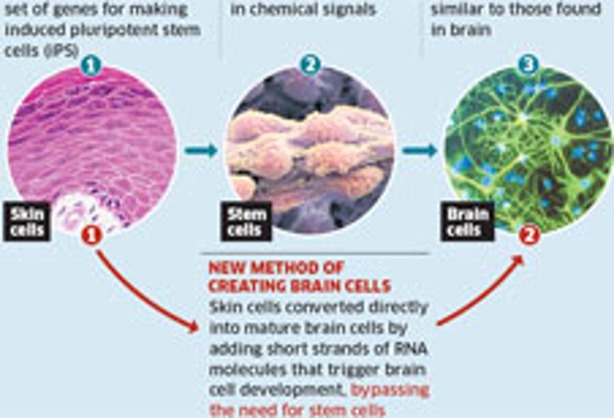 Hope for millions of Alzheimer's sufferers as scientists make brain ...