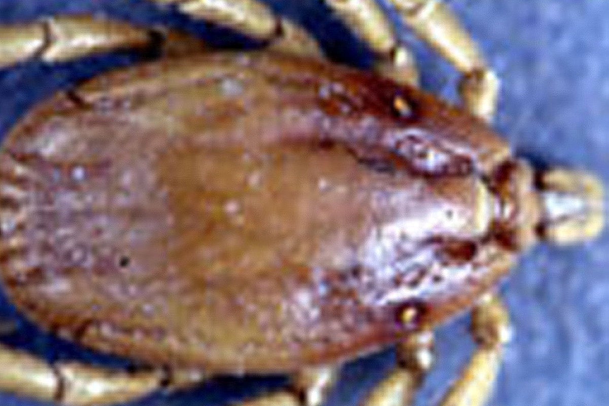 Patient with rare fever dies in UK hospital | The Independent | The ...