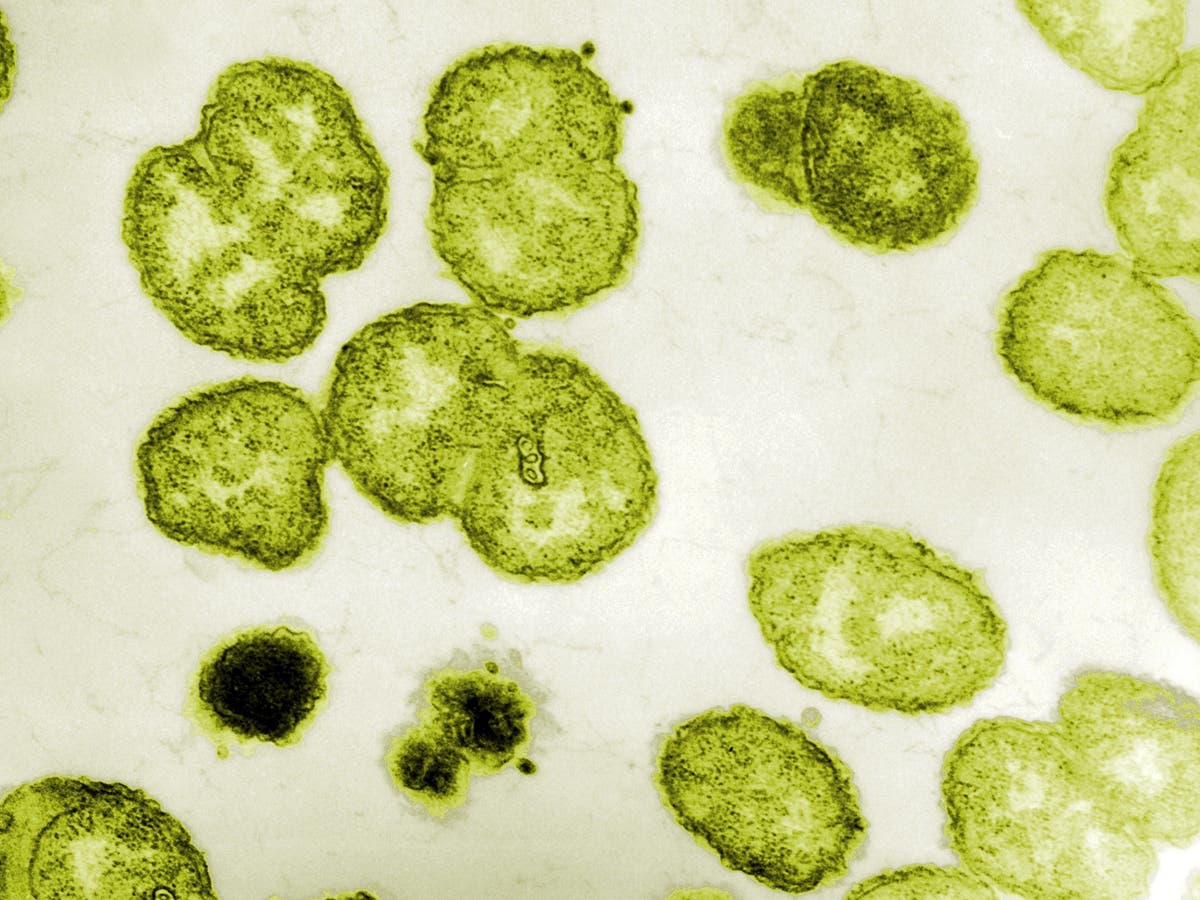Super-gonorrhoea cure could come from new treatment for drug-resistant ...
