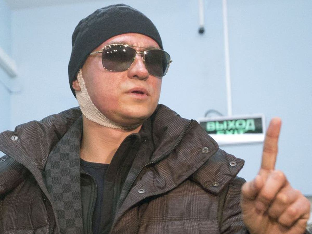 Russian police arrest man over acid attack on Bolshoi director Sergei ...