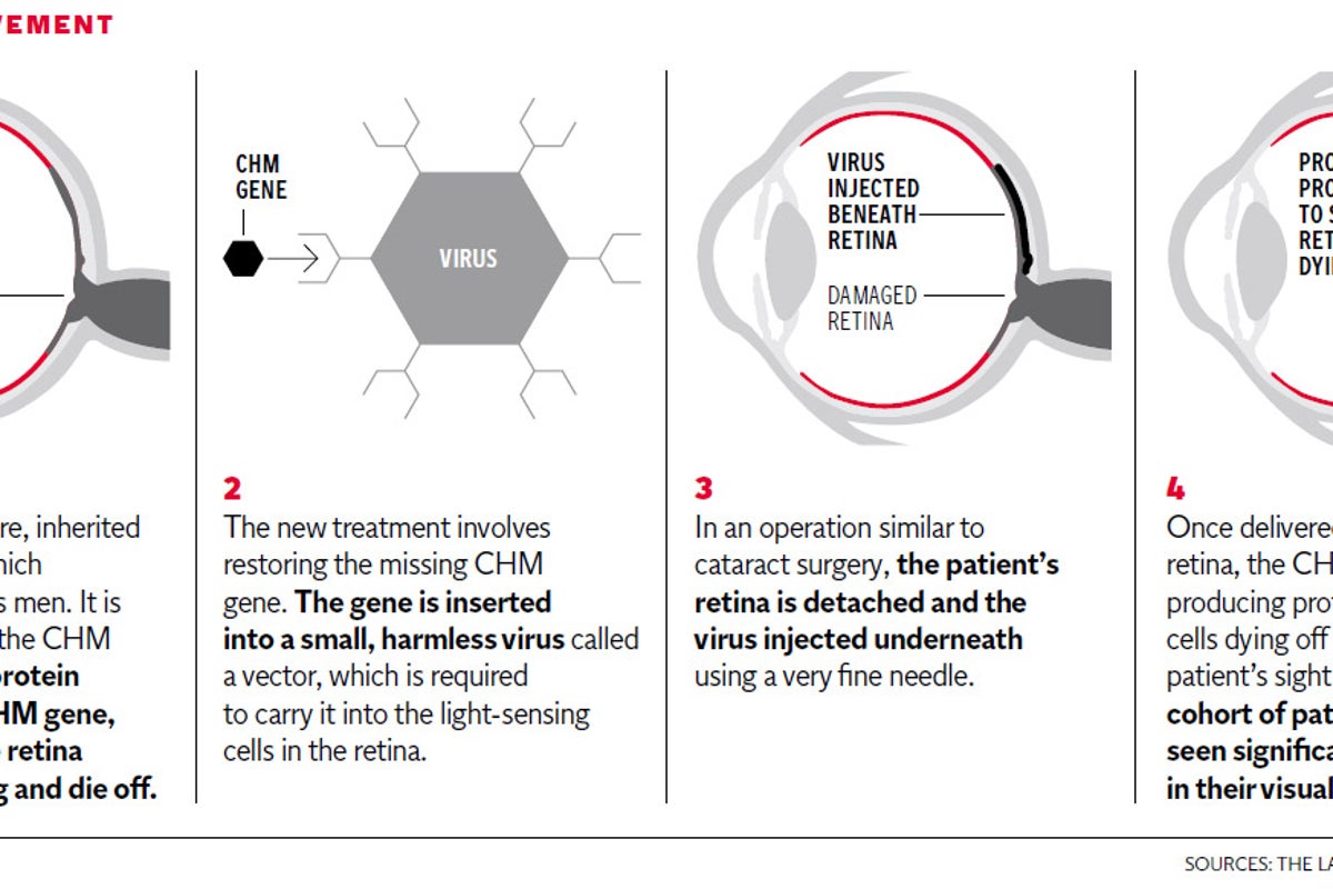Pioneering first gene therapy trial opens the door for reversing some ...