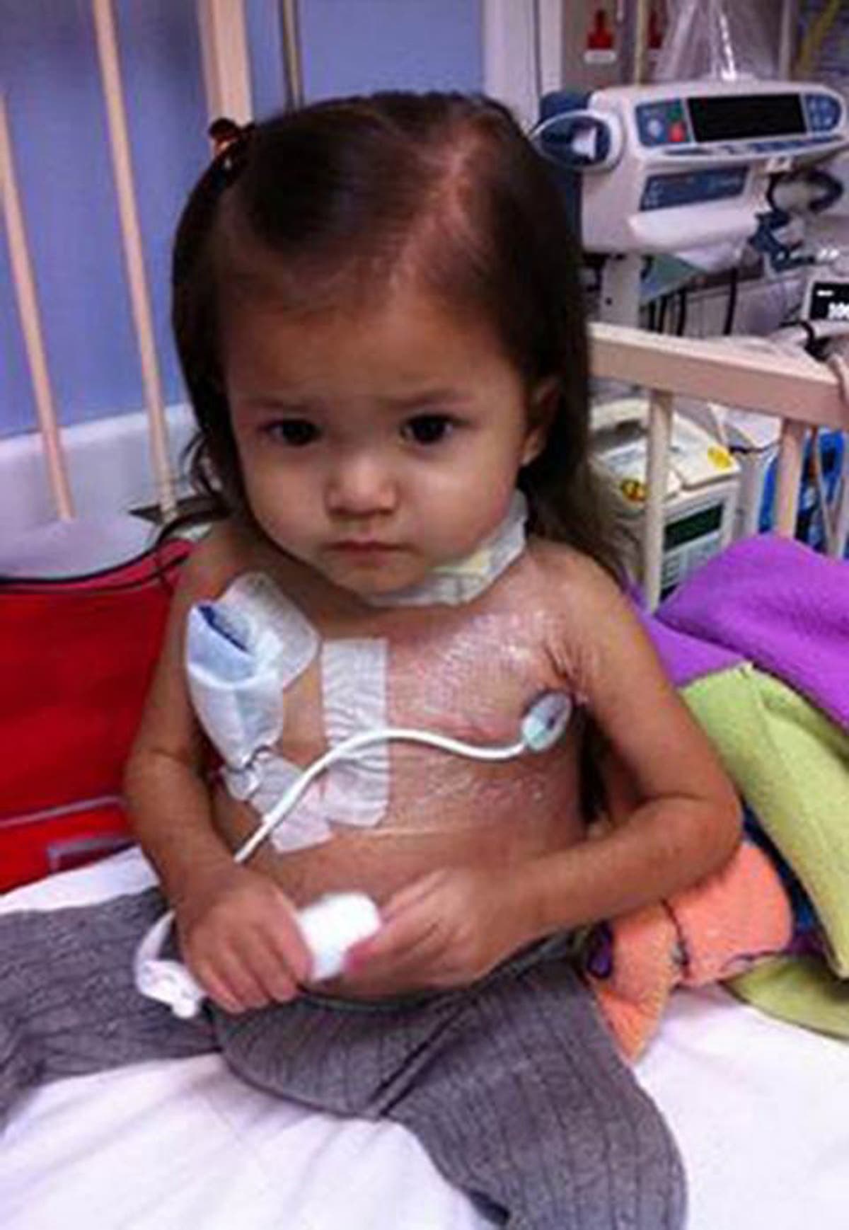 Desperately ill toddler Tia Pugh needs bone marrow transplant to save ...