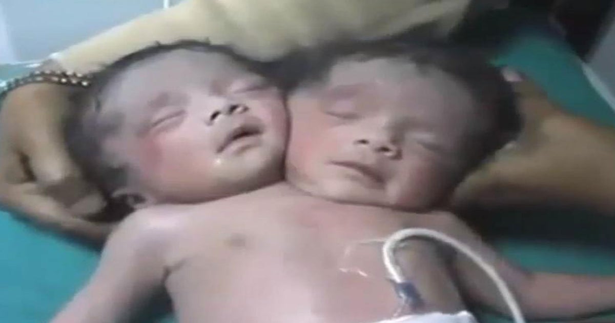 2 Headed Baby MOTHER'S DAY 2020 A DAY IN THE LIFE OF A SIDESHOW MOM
