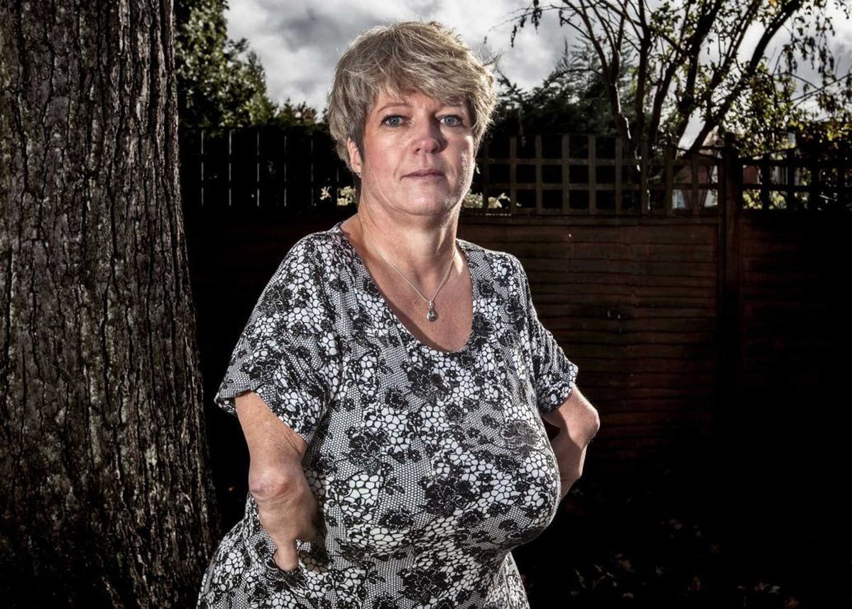 Thalidomide: the Fifty Year Fight, TV review: The powerful story of the ...