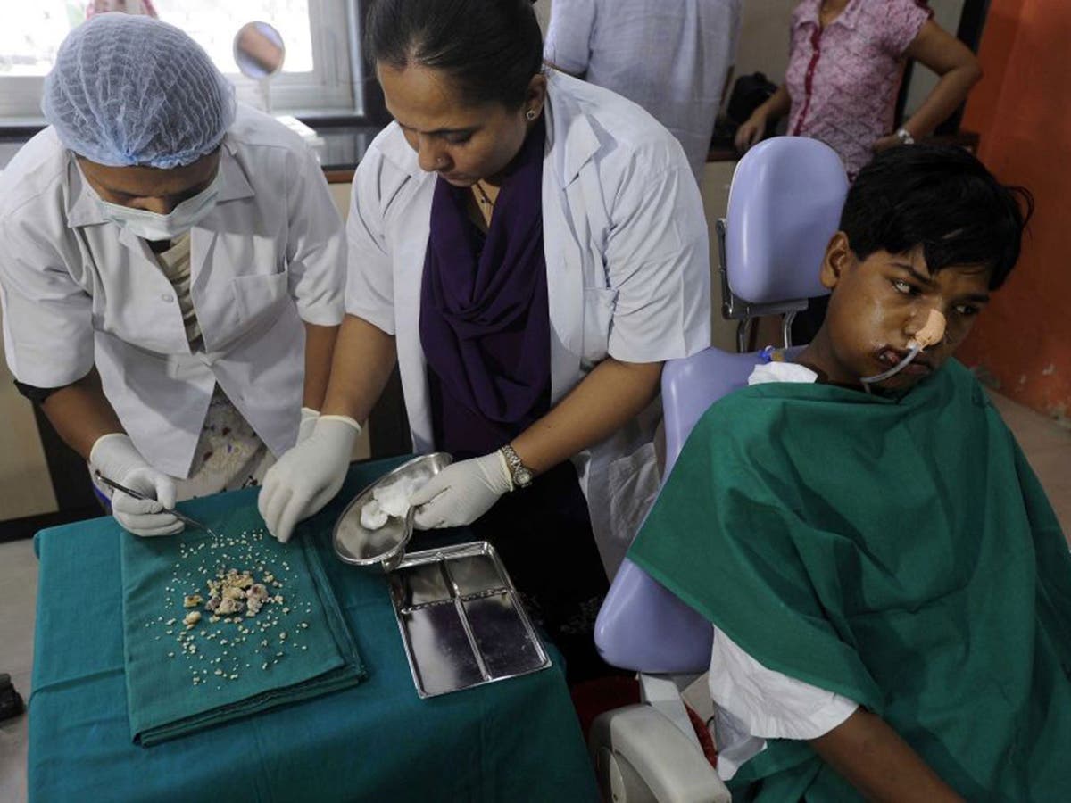 Doctors in India extract 232 teeth from boy's mouth | The Independent ...