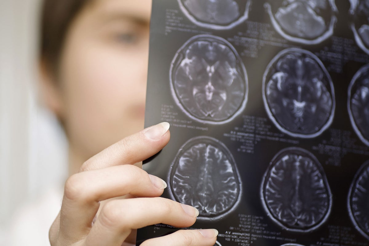 The difference between psychopaths and anti-social people lies in brain ...