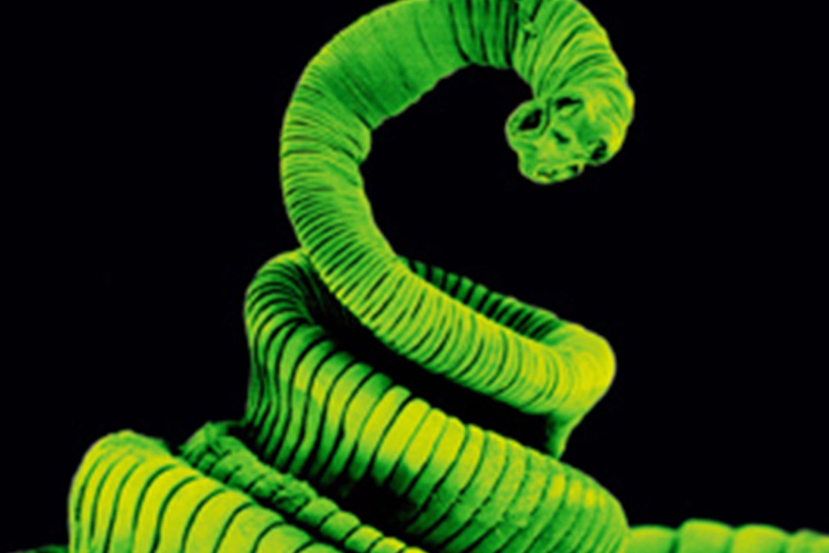 20ft tapeworm discovered inside man suffering with stomach pains | The ...