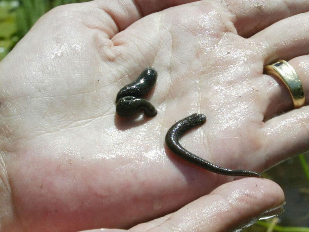 British woman returns from south-east Asia with three-inch leech living ...