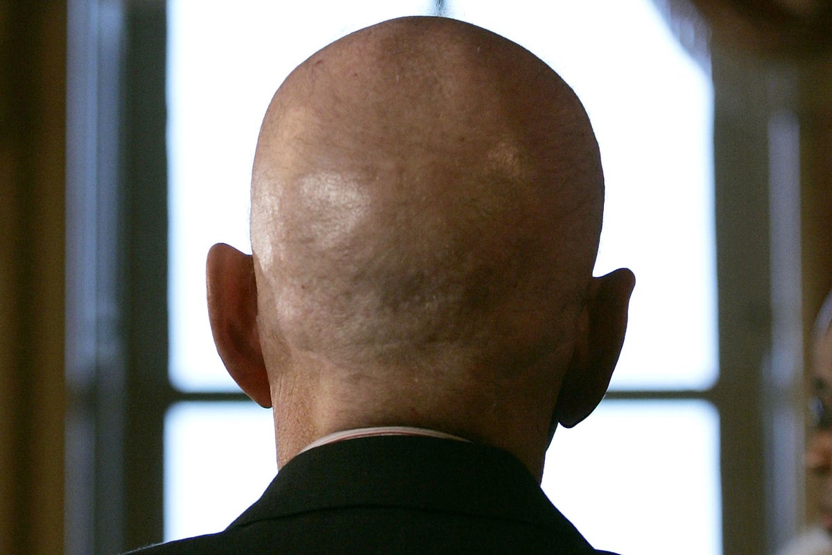 Baldness could soon be treated using stem cells, scientists hope | The ...