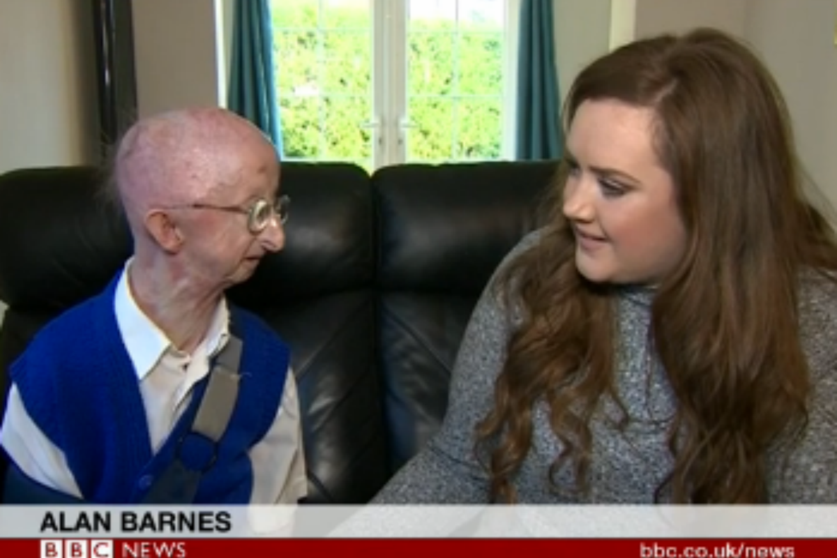 Alan Barnes: Disabled pensioner who was mugged outside his own home ...