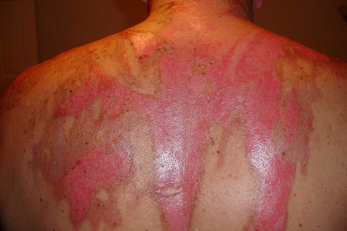 Male Domestic Violence Victim I Never Imagined Something Like This