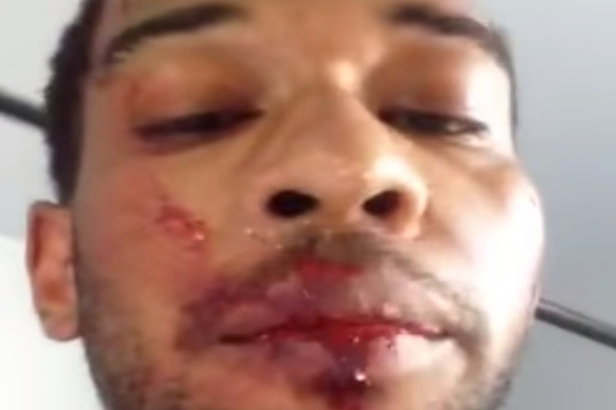 Ronald Moon: Cincinnati man posts video message showing injuries he ...