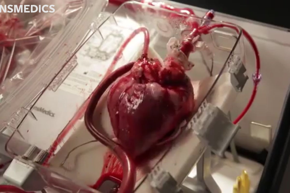 This revolutionary technology is keeping hearts beating outside the ...