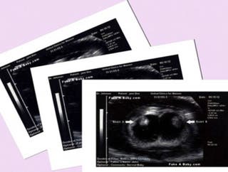 Teenage girl 'fakes pregnancy with FakeABaby.com after losing triplets ...