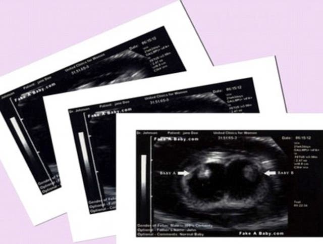 Teenage girl 'fakes pregnancy with FakeABaby.com after losing triplets ...