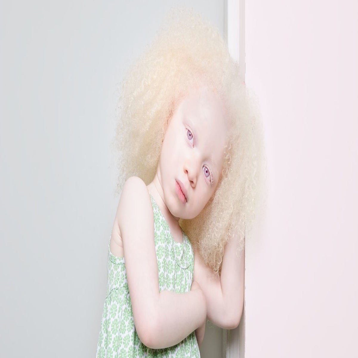 Beautiful People With Albinism