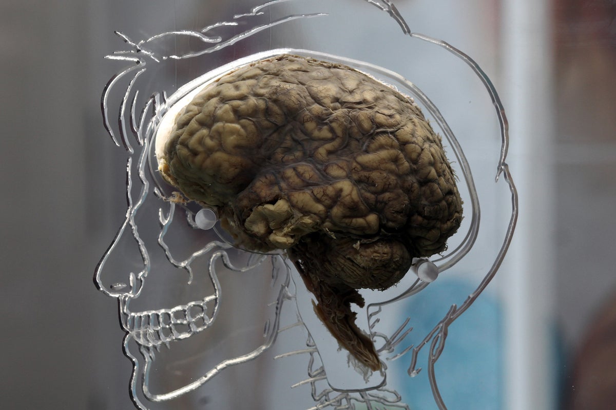 What is Cotard's syndrome? The rare mental illness which makes people ...