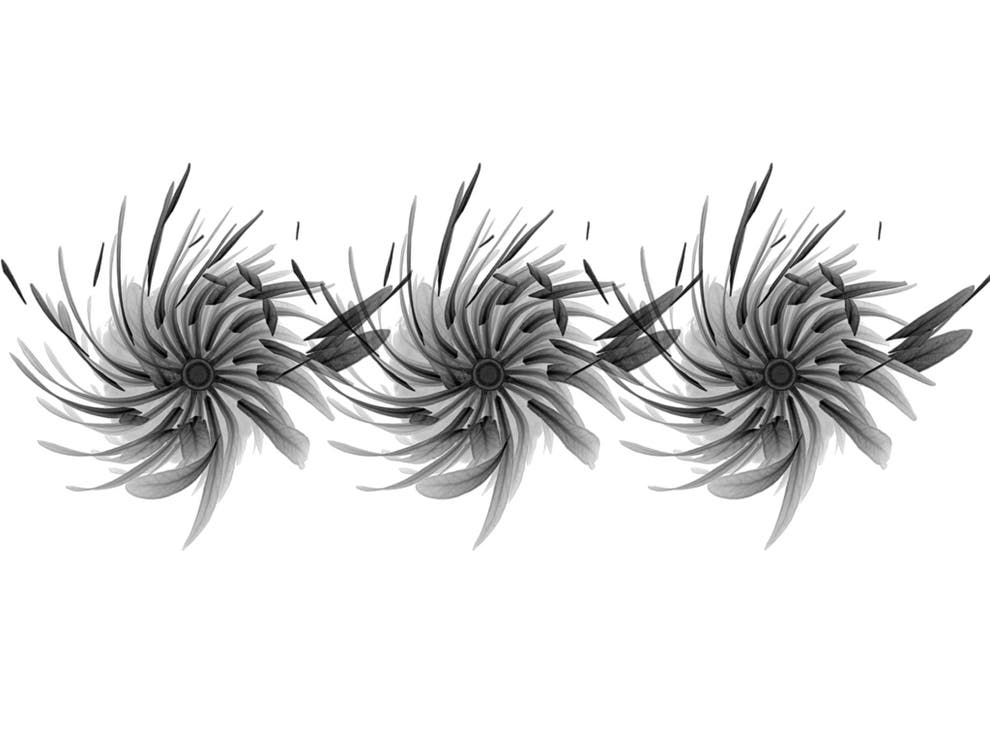 X-ray exhibition marks artist's return to health after serious illness ...