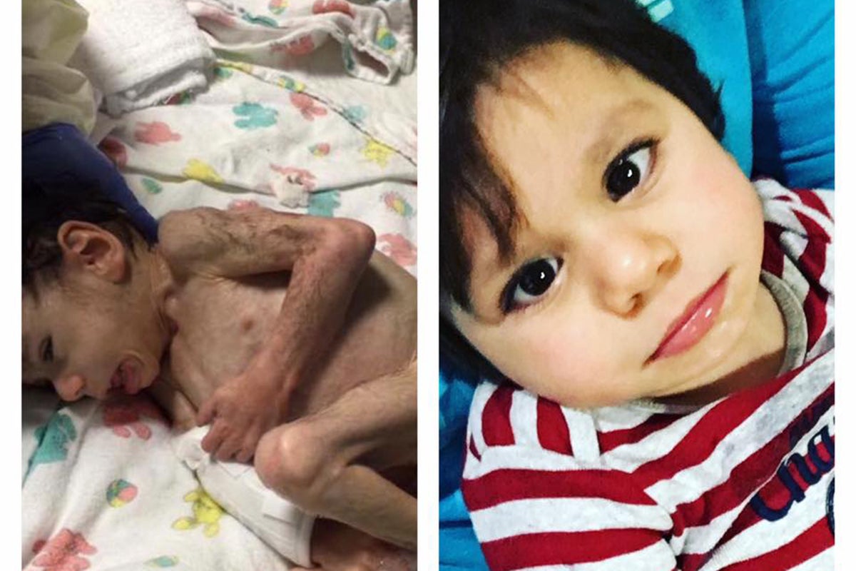 Pictures show starving Bulgarian orphan's incredible transformation ...