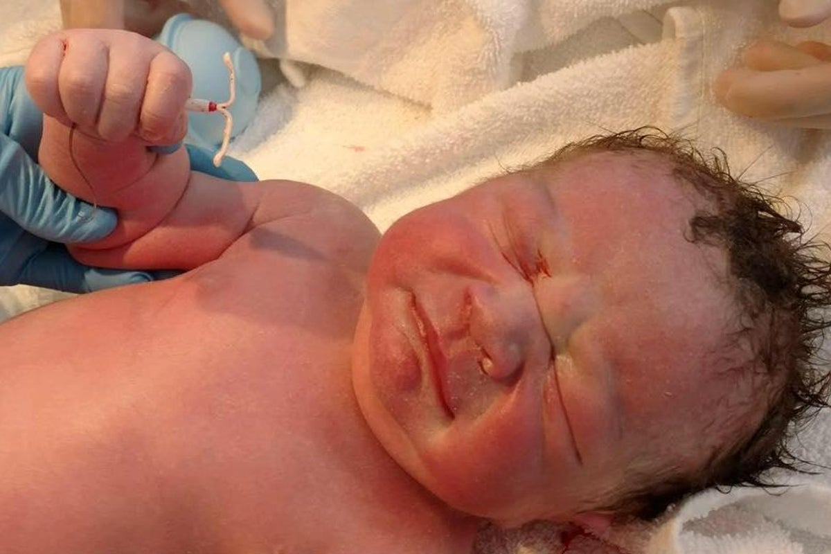 Mother shares photo of baby holding coil that was meant to prevent ...