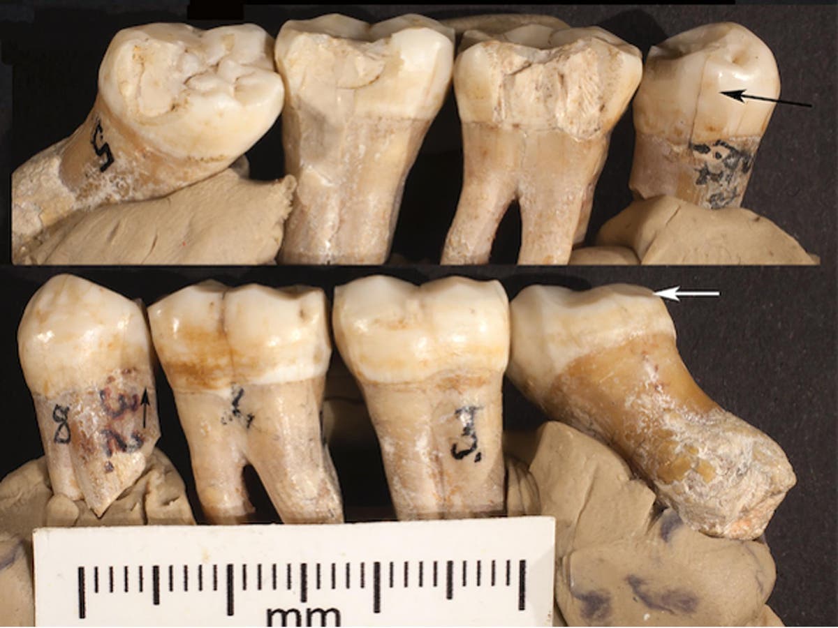 Neanderthals attempted dentistry 130,000 years ago, believe scientists ...