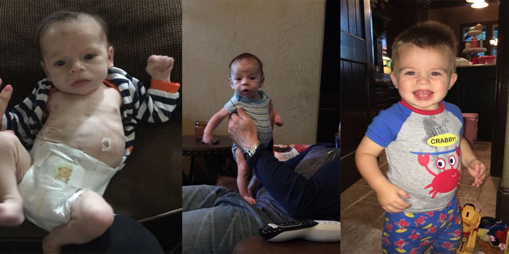 Baby born to drug addict parents is going viral after remarkable ...