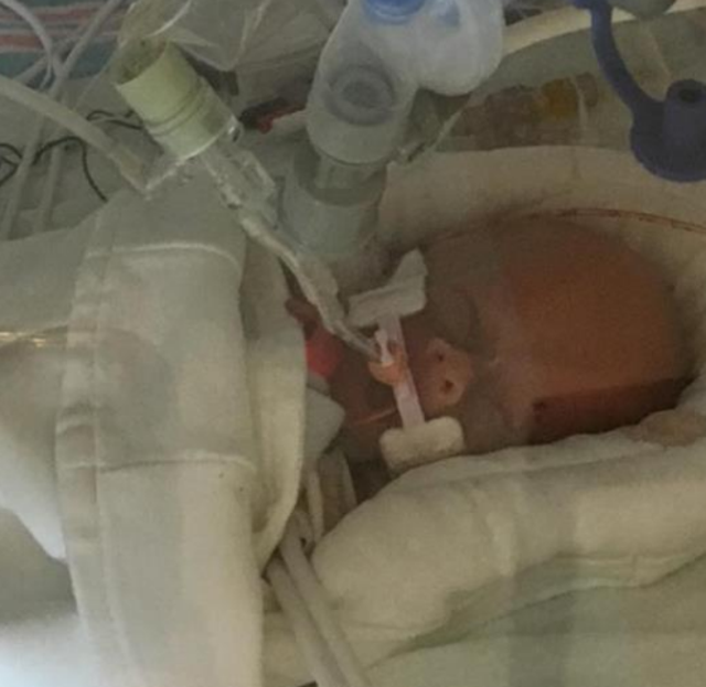 Premature baby dies 12 days after comatose mother with brain cancer ...