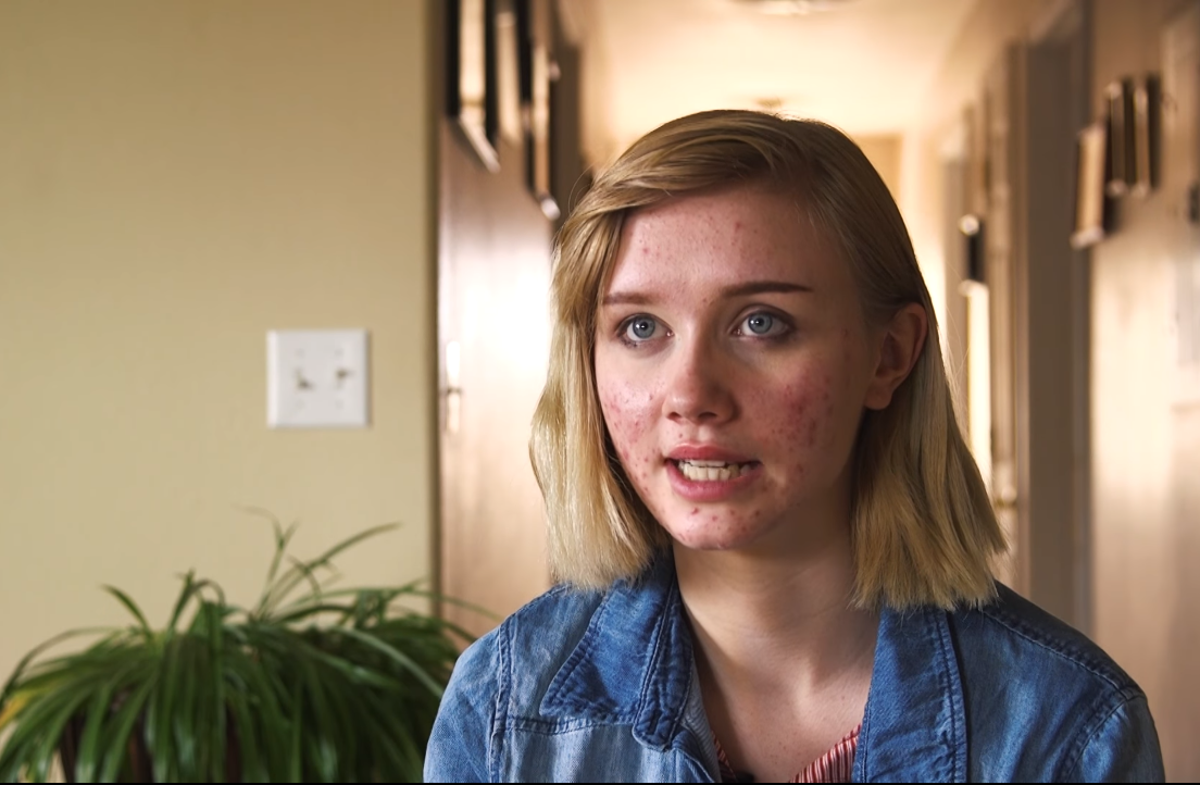 Teen with cystic acne shares powerful message about embracing yourself ...