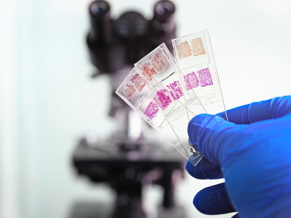 Interstitium: New organ discovered in human body after it was ...