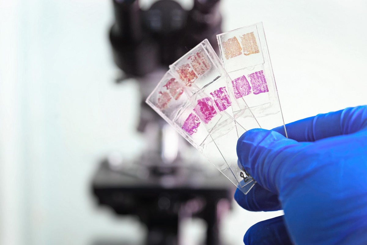 Interstitium: New organ discovered in human body after it was ...