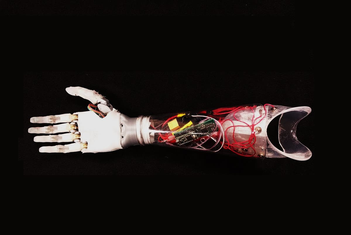 Prosthetic limb delivers realistic feeling to amputees thanks to new AI ...